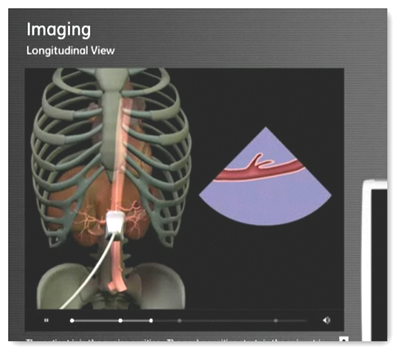 Portable Vscan Ultra-Sound From GE is Now Available for Purchase ...